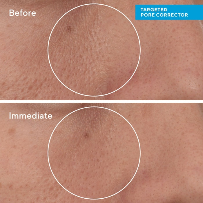PORE MINIMISING BUNDLE OFFER (PACK OF 4)